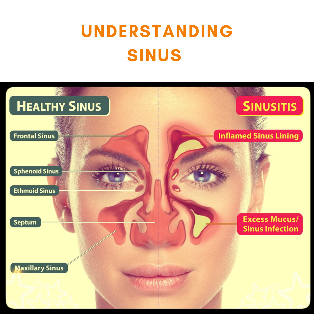 UNDERSTANDING SINUS - Health Holistic UNDERSTANDING SINUS - Health Holistic